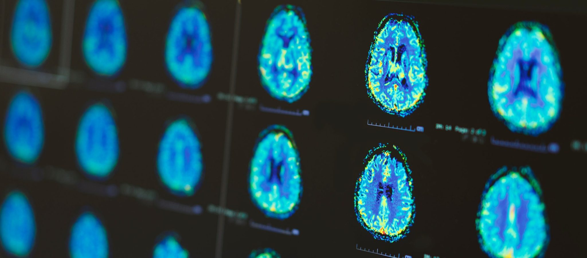 world brain mapping foundation